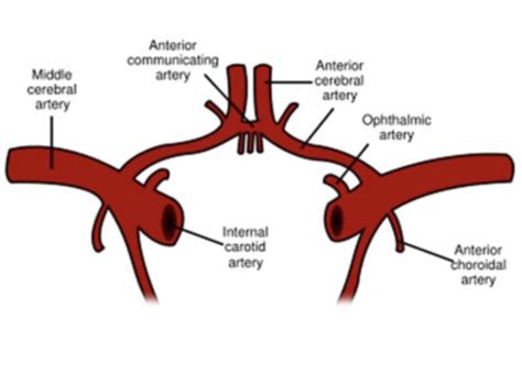 Cva Stroke 49 Flashcards Quizlet