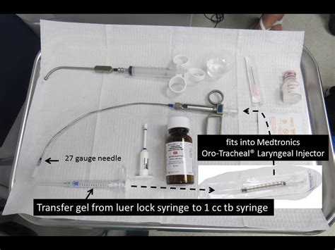 Vocal Cord Injection With Prolaryn Gel With Videostroboscopy Transoral