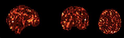 Fix Basil Parameters · Issue 1447 · Exploreaslexploreasl · Github