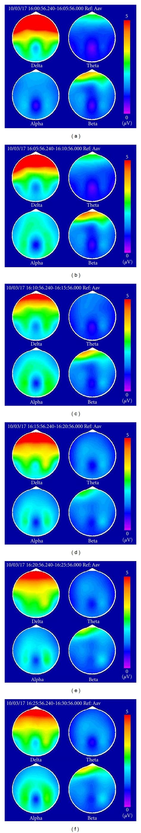 a f the power spectrum maps of eeg in the six sessions of one