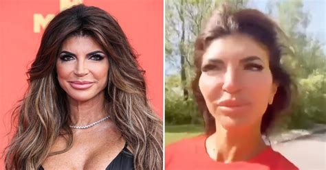 Teresa Giudice Looks Unrecognizable As Doctors Reveal What Plastic