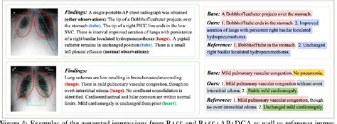 Figure 4 From Improving Radiology Summarization With Radiograph And Anatomy Prompts Semantic