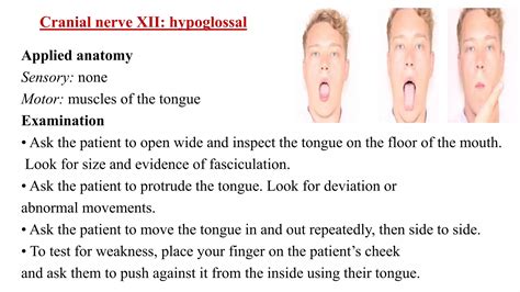 Cranial Nerves Examination Pptx