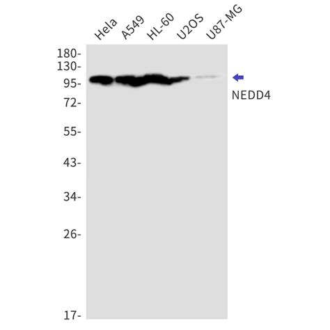 Anti Nedd4 Antibody [s06 7c3] Ab317414 Abcam