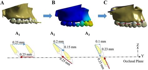Loading Method Of The Finite Element Model To Simulate Incisor Download Scientific Diagram