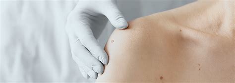 Atopic Dermatitis Serum Skin Clinic