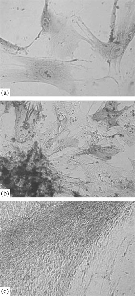 The Cultures Of Fibroblast Like Progenitor Cells Derived From Human