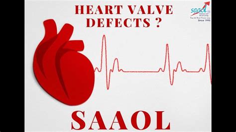 Heart Valve Defects Heart Valves Valve Heart