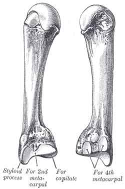 Third Metacarpal Bone Wikipedia