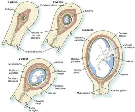 Chorion Laeve Placenta