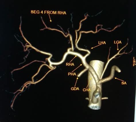 Surendhar Dinagaran On Linkedin Ctscan Radiographer Radiology
