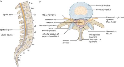 Lumbar Puncture Anatomy Layers Lumbar Puncture Anatomy Layers