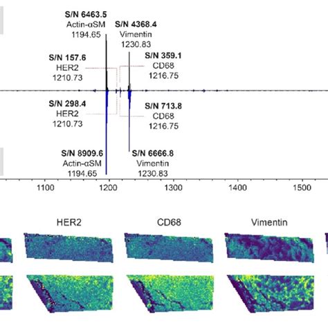 Timstof Maldi 1 Vs Maldi 2 On Breast Cancer Tissue Samples From Patient
