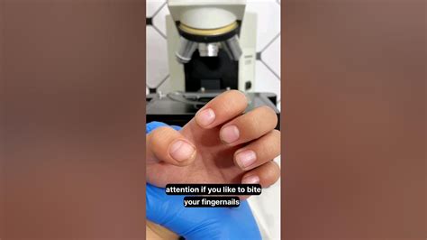 Shortvideo Microscope Microscopeview Youtube