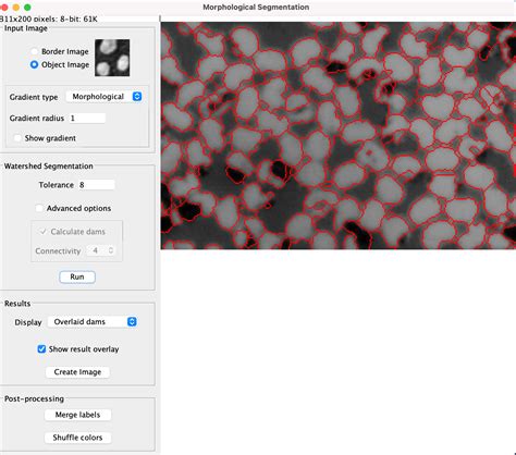 Image Segmentation Using Imagej Image Analysis Imagesc Forum