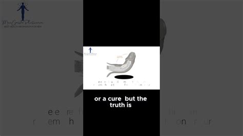 Start And Stop Technique For 2025