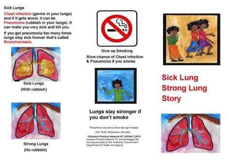 Posters And Pamphlets Bronchiectasis