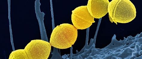 Invasive Group A Streptococcus Igas Infection Remains Rare Say