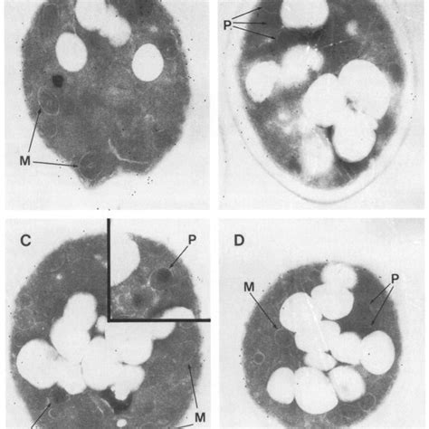 Subcellular Localization Of Various Forms Of Catalase Expressed In Download Scientific Diagram