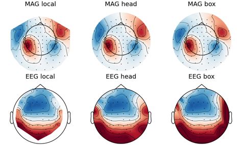 plotting topographic maps of evoked data — mne 1 10 0 documentation
