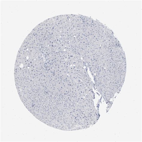 Tissue Expression Of Ppard Staining In Liver The Human Protein Atlas