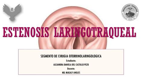 Resúmenes De Estenosis Laringotraqueal Descarga Apuntes De Estenosis