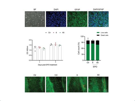 Glial Suppression Archives Striatech