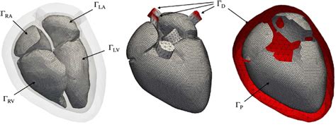 surfaces on which boundary conditions are applied the endocardial
