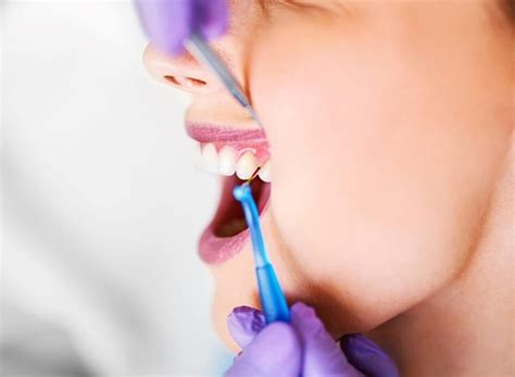 Gingivitis Diagnosis And Treatments In Beverly Hills Ca