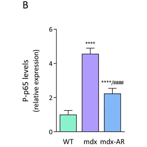 Effects Of Adiporon Treatment On Ampk Activity Nf‐κb Activity And