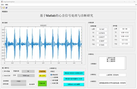 基于matlab的心音信号处理与诊断研究 心电心音 分割心动周期 s1 s2 matlab csdn博客