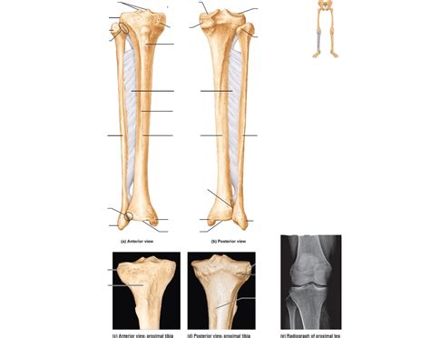 Label Tibia Quiz