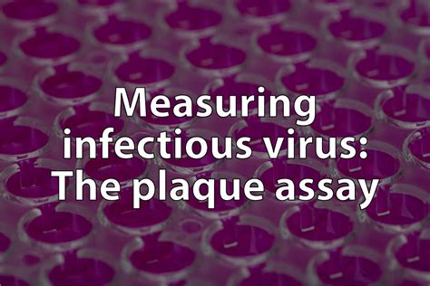 Assay Of The Month The Microneutralization Assay Virology Research