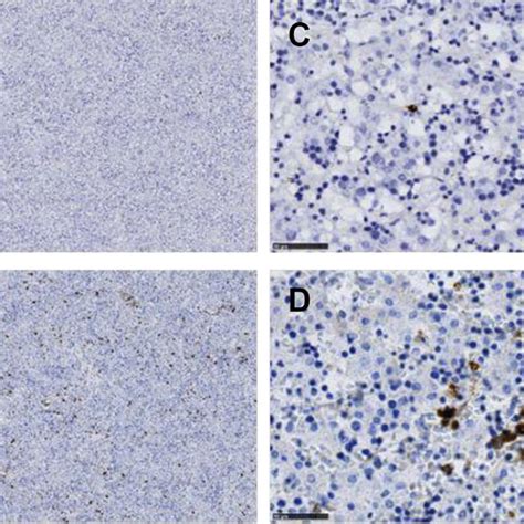 Positive Control Obtained From Embryonic Liver With Extramedullary Download Scientific Diagram