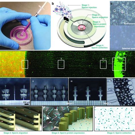 Sperm Assessments Before And After Su And Microfluidic Sperm Selection