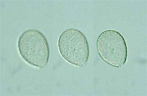 Protist Images Assulina