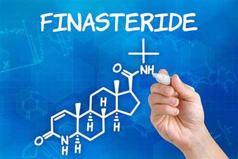 Five Things You May Not Know About Finasteride