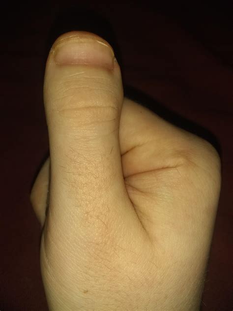 I Have Toe Thumbs Rmildlyinteresting
