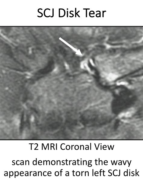 Scj Conditions Cambridge Shoulder