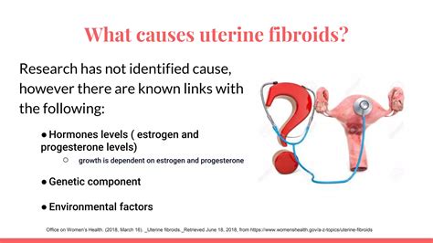 Diagnostic Imaging In Uterine Fibroids Potx