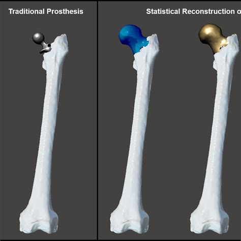 Morphological Variation Between Statistically Reconstructed Healthy
