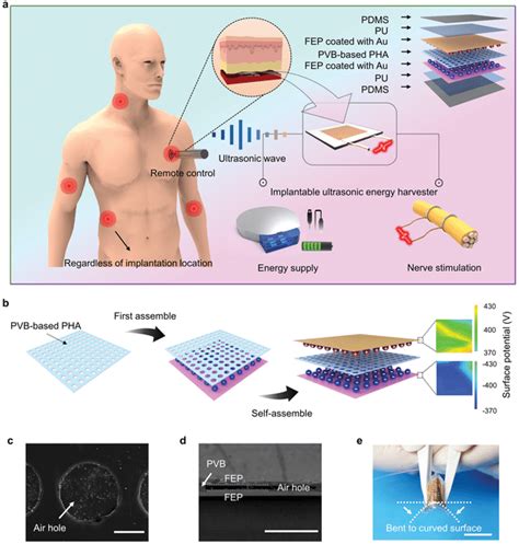 Overview Of H‐euh System A Illustration Of H‐euh As Implantable Download Scientific Diagram