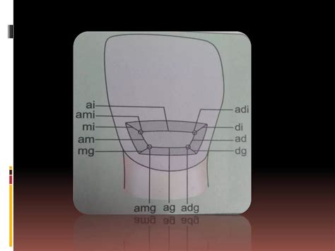 Management Of Class V Caries Pptx