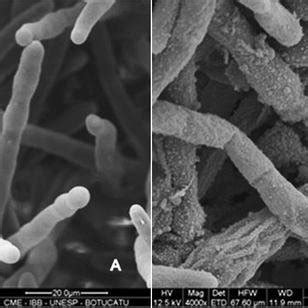 Scanning Electron Microscopy Of Pythium Insidiosum From Control Group Download Scientific