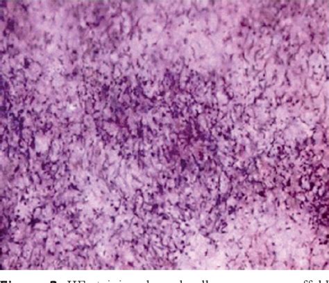 Figure 1 From The Impact Of Collagen Sponge Composite Bone Marrow Mesenchymal Stem Cells Bmscs