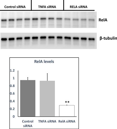 Figure from TNF α and NF κB signaling play a critical role in cigarette smoke induced