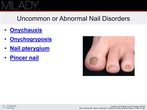 Nail Disorders And Diseases Basic Introducion Pptx