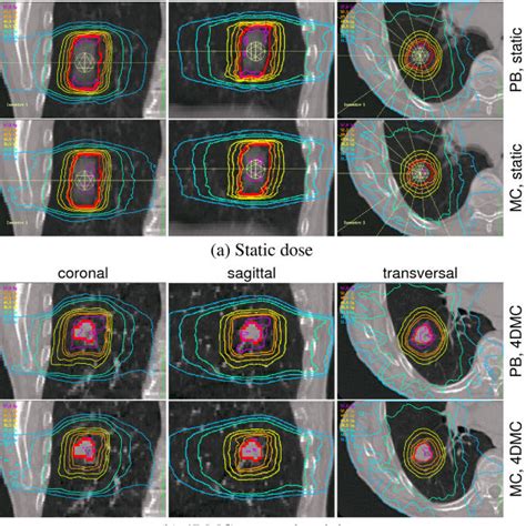 Dose Distribution Isodoses Example Of The Resulting Dose Distributions Download Scientific
