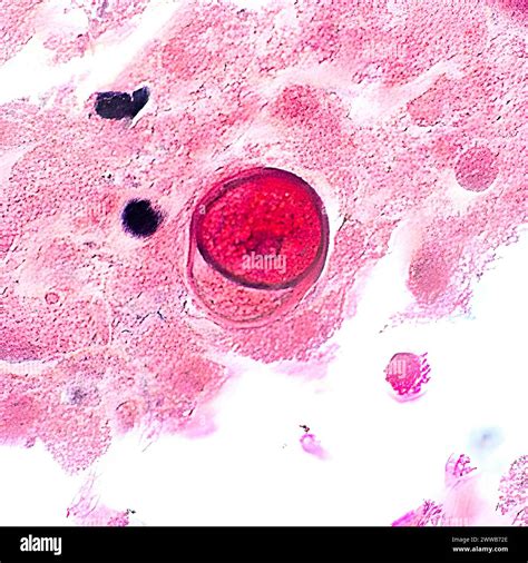 Acanthamoeba Is A Microscopic Free Living Amoeba Or Amoeba Single Celled Living Organism