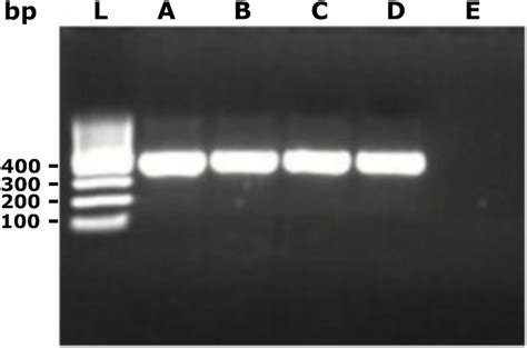 Gel Image Of The Hemi Nested Pcr Products Used For Sequencing L